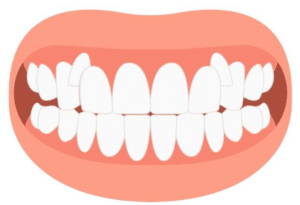 Clear Aligners | Invisalign® | Teeth Straightening | Orthodontist Near ...